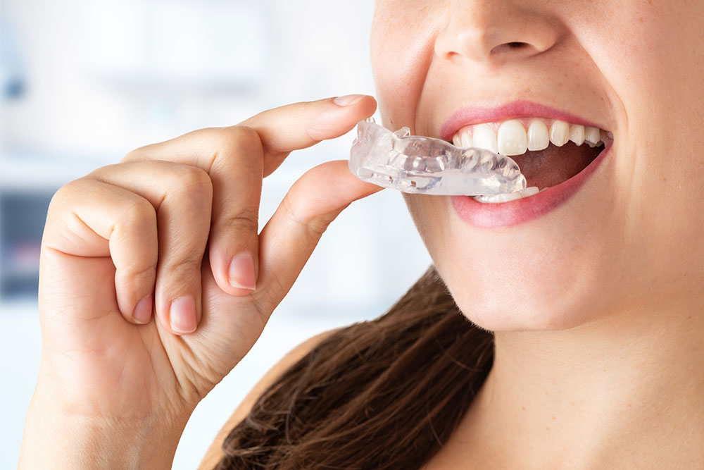 Avantages Plaque Occlusale pour Éviter le Grincement des Dents